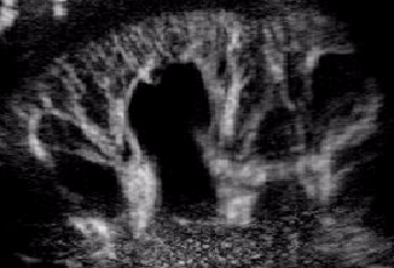 Maestro Universal System - Optoacoustic Tomography And Laser Ultrasound ...