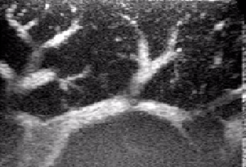 Maestro Universal System - Optoacoustic Tomography And Laser Ultrasound ...