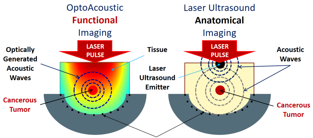 Advanced LASER Ultrasound Imaging for Image-Guided Surgery